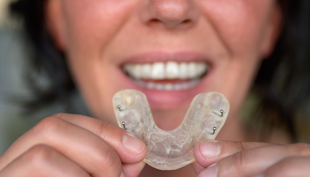 The Benefits of Night Guards for Teeth Grinding